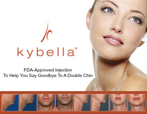 Kybella El Centro Double Chin Treatment El Centro