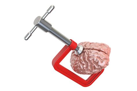 인간의 두뇌와 클램프 두통 및 스트레스 개념 3d 렌더링 3차원 형태에 대한 스톡 사진 및 기타 이미지 3차원 형태 감정 개념과 주제 Istock