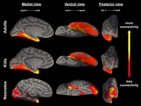 Connectivity Between The Lateral Subnucleus And The Entire