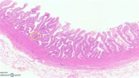 Histologia Da Vesicula Biliar Rotulada