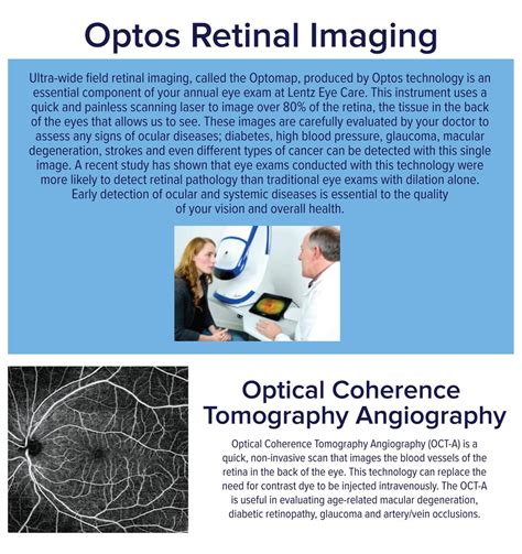Optos Retinal Imaging