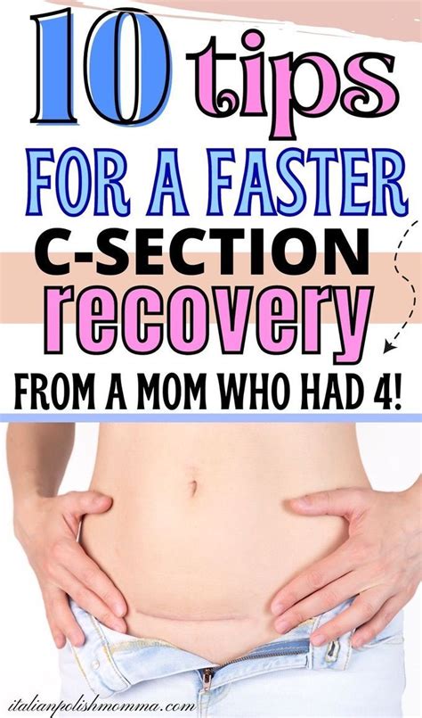 How To Lose The C Section Pooch Artofit