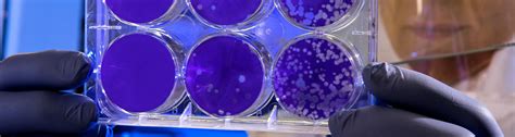 Understanding Microbiological Standards
