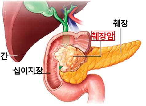 스티브잡스 사망원인 네이버 블로그
