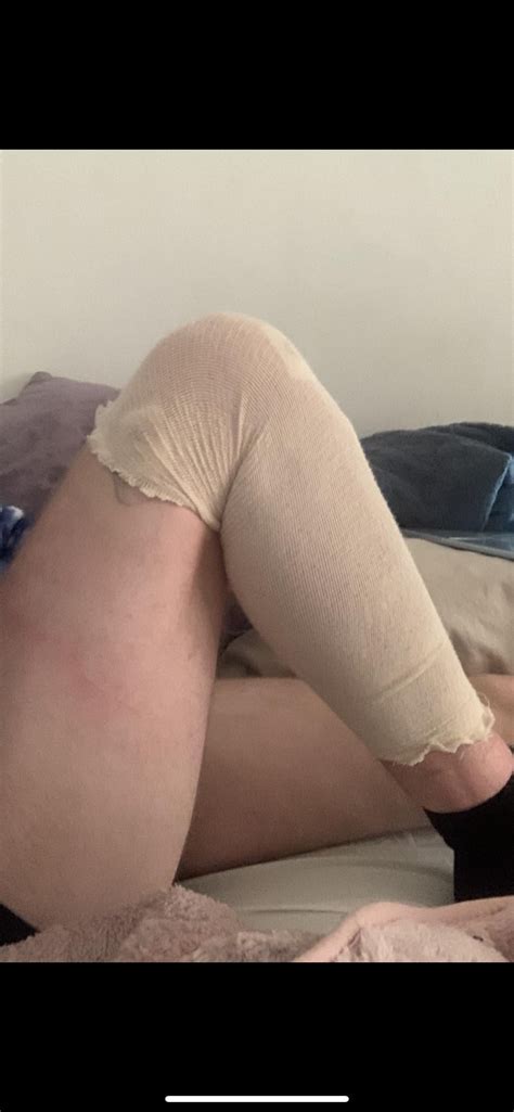 Day 5 Post Acl Reconstruction Hamstring Graft First Physio Today And