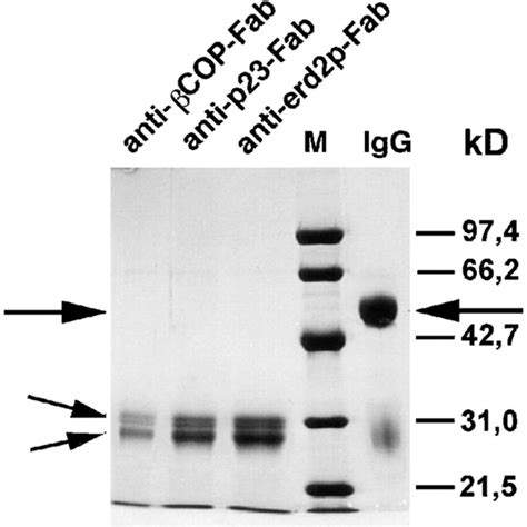 Sds Page Reducing Conditions Of Fab Fragments Prepared From Iggs