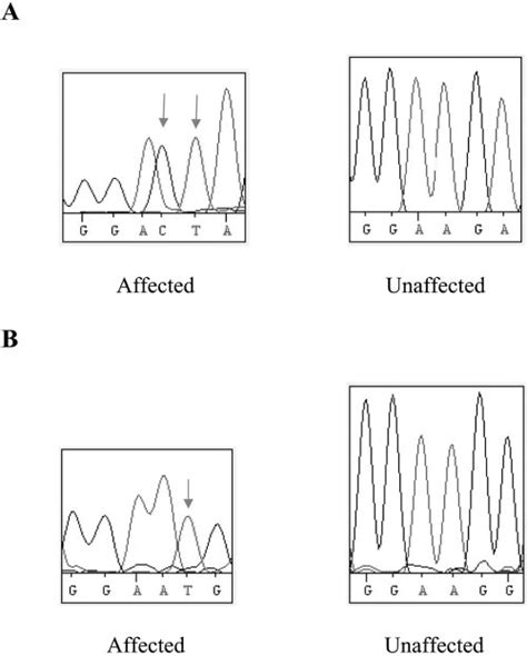 Representative Electropherograms Showing Affected Male Mutations In