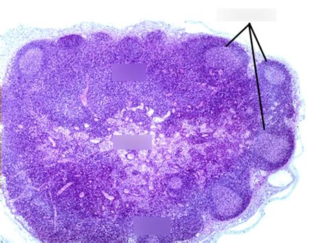 Lymph Node Diagram Quizlet