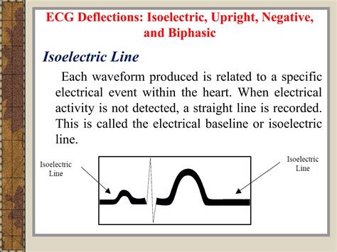 Ecg For Nurses Ppt
