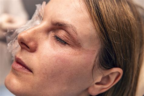 Fibroblast Beautypedia