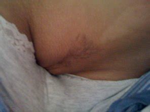 Skin Arm Joint Organ Close Up Porn Pic