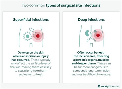 Basic Signs Of Infection At April Newton Blog