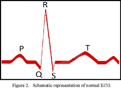 Figure From Detection Of Obstructive Sleep Apnea Through ECG Signal Features Semantic Scholar