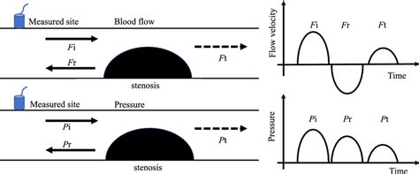 The Concept Of Superposition Of Flow Velocity And Pressure Waves Near Download Scientific