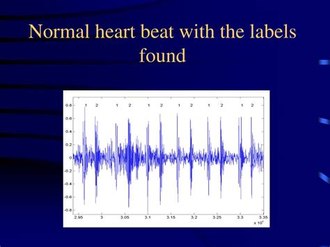 Ppt Detection Segmentation And Classification Of Heart Sounds Powerpoint Presentation Id 588880