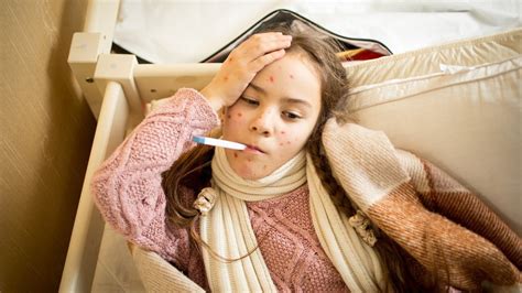 Mengenal Obat Acyclovir Yang Digunakan Untuk Cacar Hingga Herpes