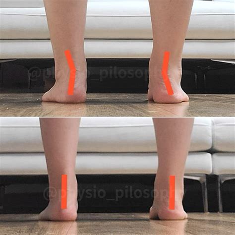 자세요정 13년차 물리치료사and필라테스 강사 ‎📣[99 만족도 전신교정 클래스 17차 모집시작] 여러분 정말정말 많이기다리셨습니다 수많은 후기들과 많은 사랑을