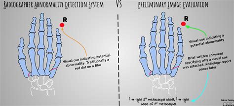 Radiographer Based Image Interpretation In The Setting Of Australia