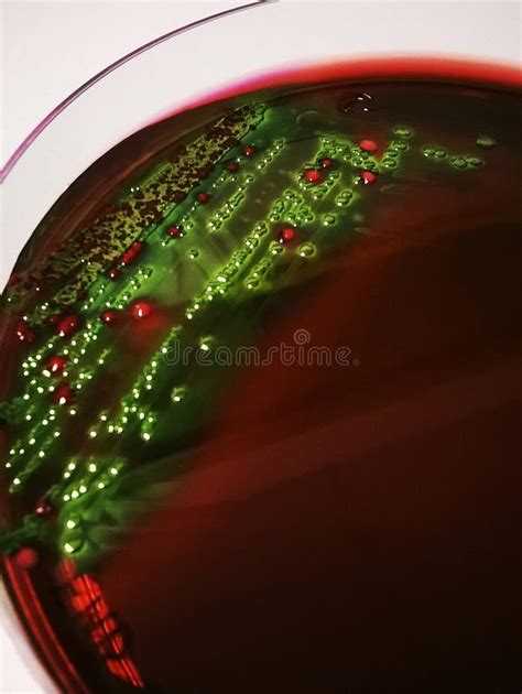 Li On Emb Agar Stock Image Image Of Growing Cells 56364417