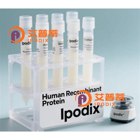 Notch1抗体notch1 Antibody—艾普蒂 Chemicalbook