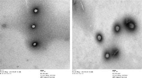 Tem Photomicrographs Of Optimized Ethosomes Left And Optimized Binary Download Scientific