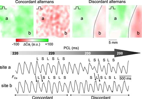 Spatially Concordant And Discordant Cai Transient Alternans During Download Scientific Diagram