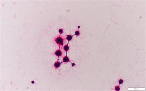 Cryptococcus Neoformans Gram Stain