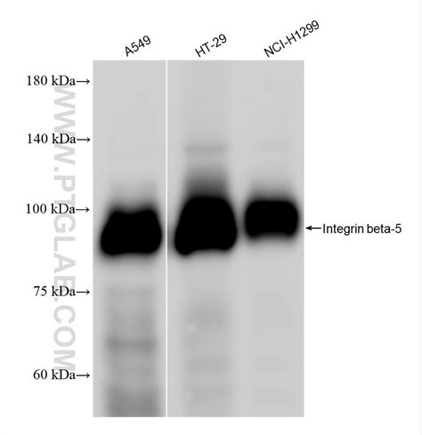Integrin Beta 5 Antibody 83514 3 Rr Proteintech