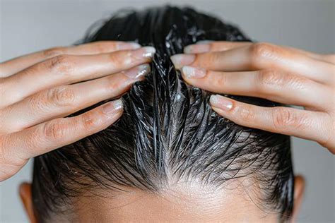 Scalp Psoriasis Treatment In Singapore What Really Works