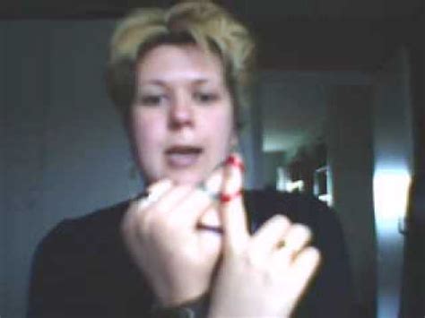 Finger Splints YouTube