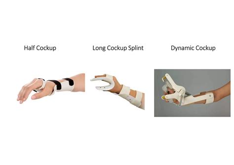 Upper Extremity Orthoses Pdf