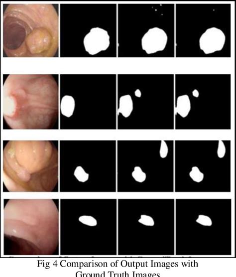 Figure 4 From Skin Cancer Segmentation Using Cnn Semantic Scholar