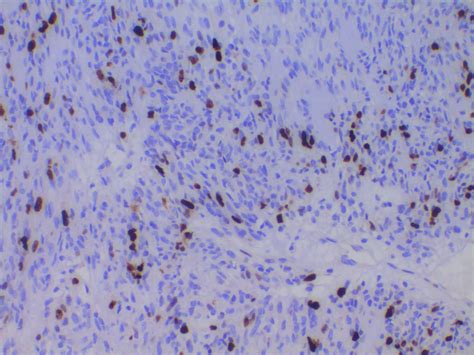 Opencv Clustering Algorithm For Detecting Colored Objects Stack Overflow