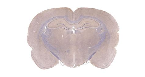 小鼠脑ihc