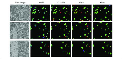 The Qualitative Comparisons Between Different Methods On The FIB SEM Download Scientific