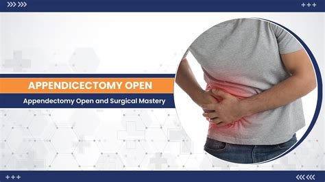 A Comprehensive Guide To Appendectomy Open And Appendicitis Recovery Wellness Hospitals