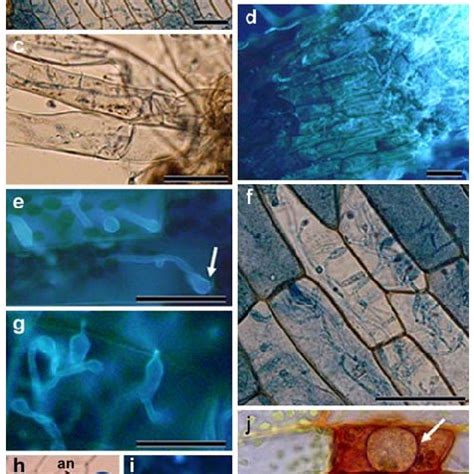Disease Symptoms In Pythium Infected Moss Tissues A PDAtreated Download Scientific Diagram