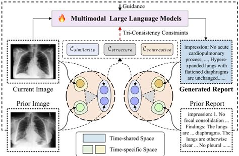 논문 리뷰 Hc Llm Historical Constrained Large Language Models For Radiology Report Generation