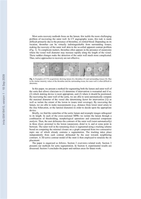 Aorta Segmentation For Stent Simulation Deepai