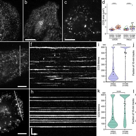 PREM Analysis Of CCS Morphology A Two Alternative Models For Download Scientific Diagram