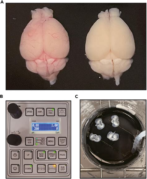 Isolation Section And Incubation Of Perfused Brain Related To Step 2
