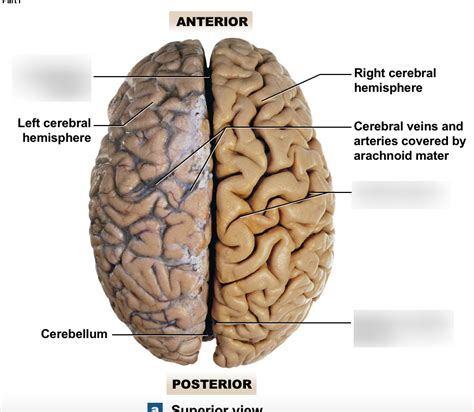 Longitudinal Fissure Brain