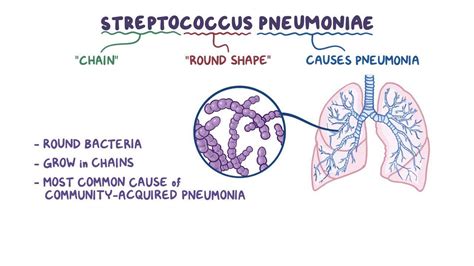 Video Streptococcus Pneumoniae Osmosis