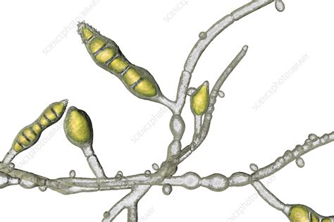 Microsporum Audouinii Fungus Illustration Stock Image F036 7235 Science Photo Library