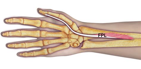 Flexor Pollicis Longus Anatomy Anatomic Structures At Risk