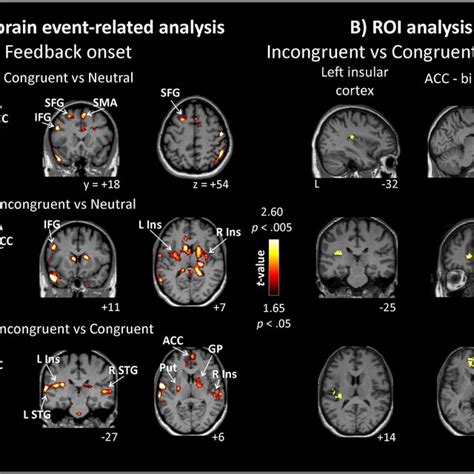 E Functional Magnetic Resonance Imaging Results A Whole Brain Download Scientific Diagram