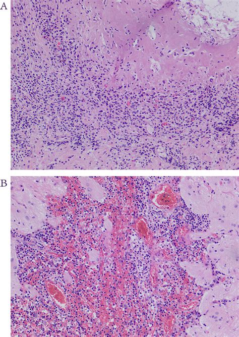 Hematoxylineosin Staining Method Displayed Under A Microscope At 200 Download Scientific
