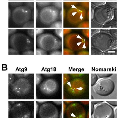 The Atg2atg18 Complex And Atg9 Are Colocalized At The Edge Of The Im