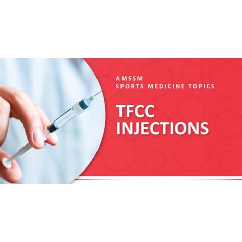 Tfcc Injections Sports Medicine Today