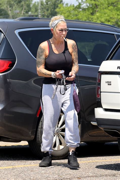 Eminems Ex Wife Kim Mathers Is Seen With Injury On Her Face Photos